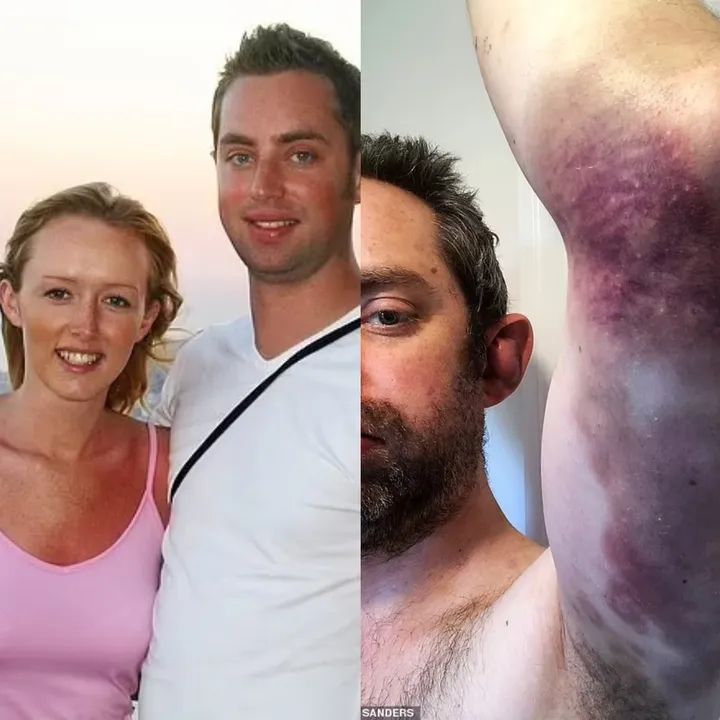 Domestic Violence : I Wore Make-up To Hide Bruises From Wife’s Beating ...
